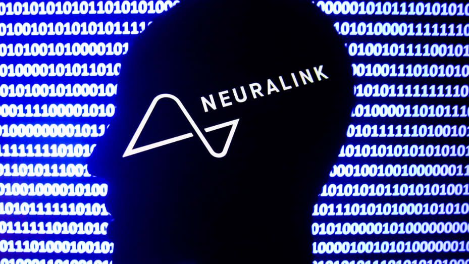 Elon Musk's Brain Chip Neuralink N1: A Step Closer to Human Implantation?