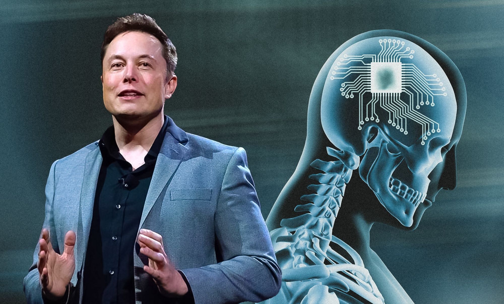 Elon Musk's Brain Chip Neuralink N1: A Step Closer to Human Implantation?